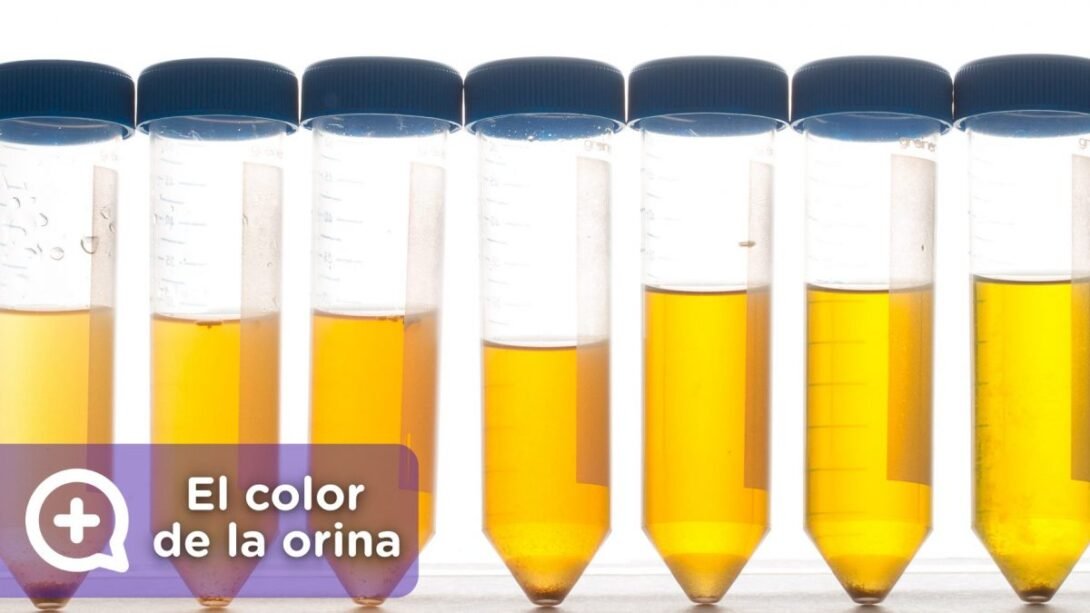 Esto dice el olor y el color de tu orina sobre tu salud: Descúbrelo ...